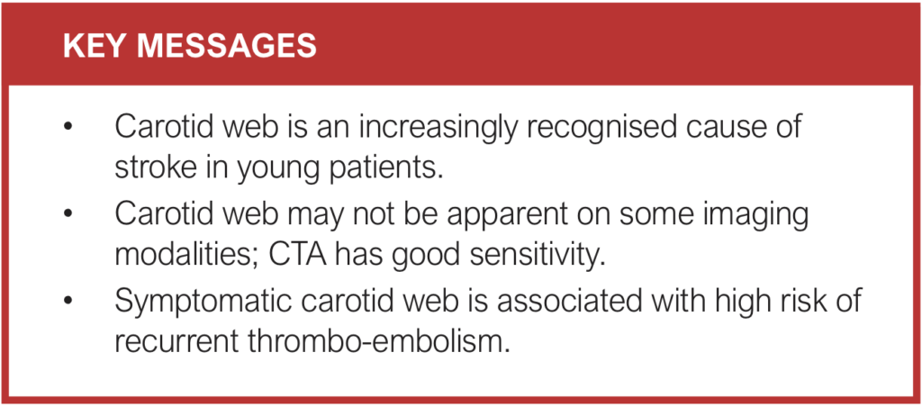 Carotid web: an important cause of stroke in young people – Journal of ...