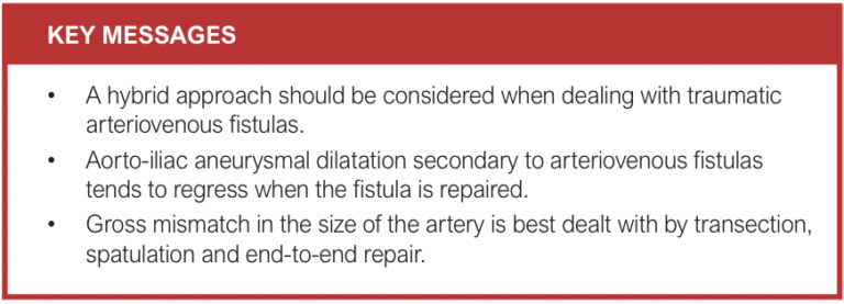 Traumatic thigh AV fistula leading to aneurysmal changes in aorta and ...