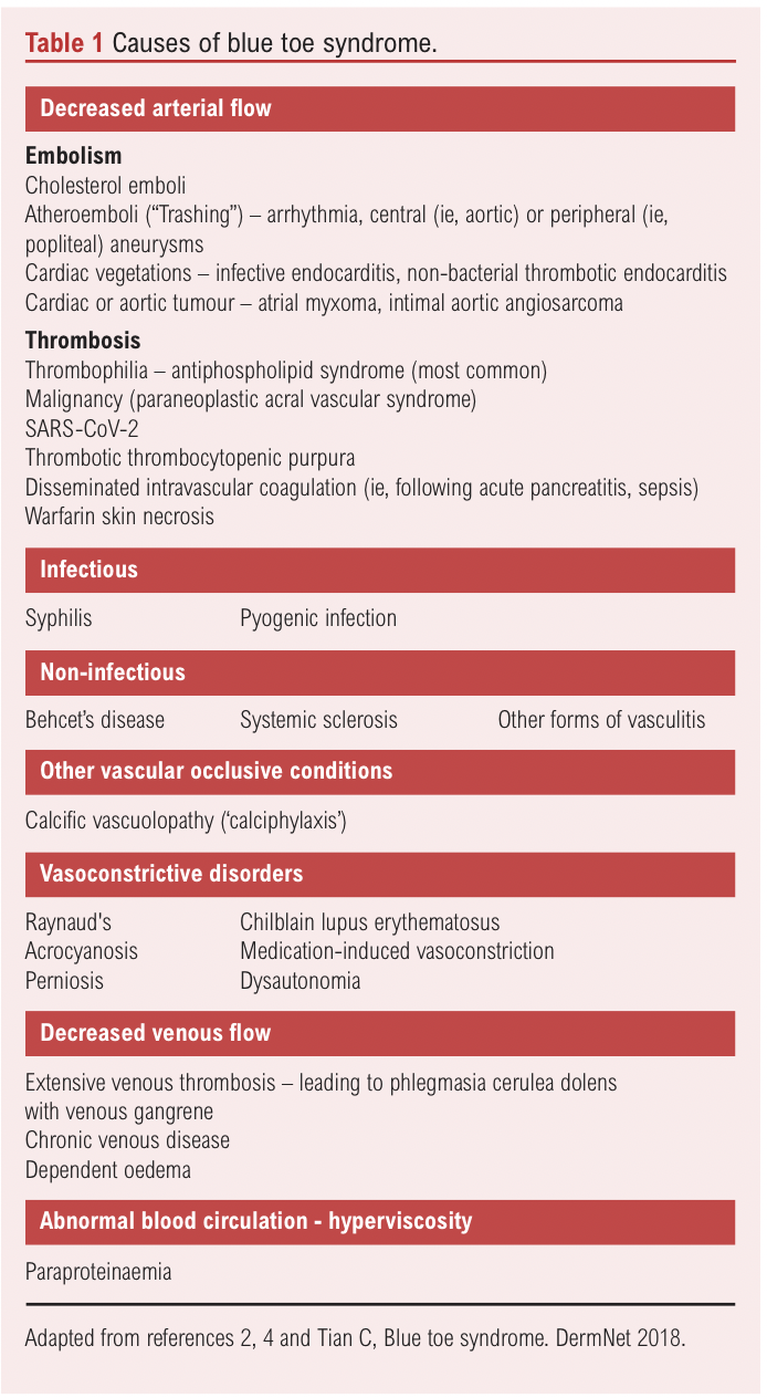 Blue toe syndrome – Journal of Vascular Societies Great Britain and ...